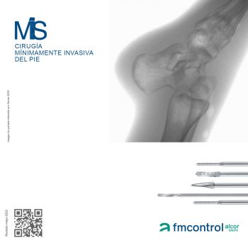 XiScan Serie 5000 - FM Control